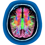 Retraining The Brain with the Dynamic Neural Retraining System